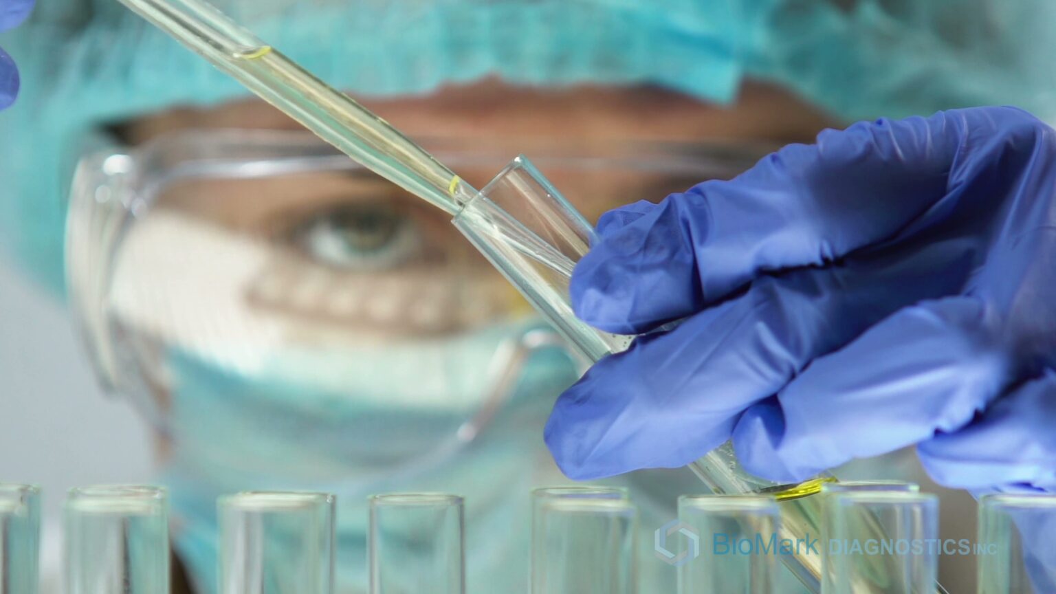 Cancer is Rising Among Women: Early Detection of Lung Cancer - Biomark ...